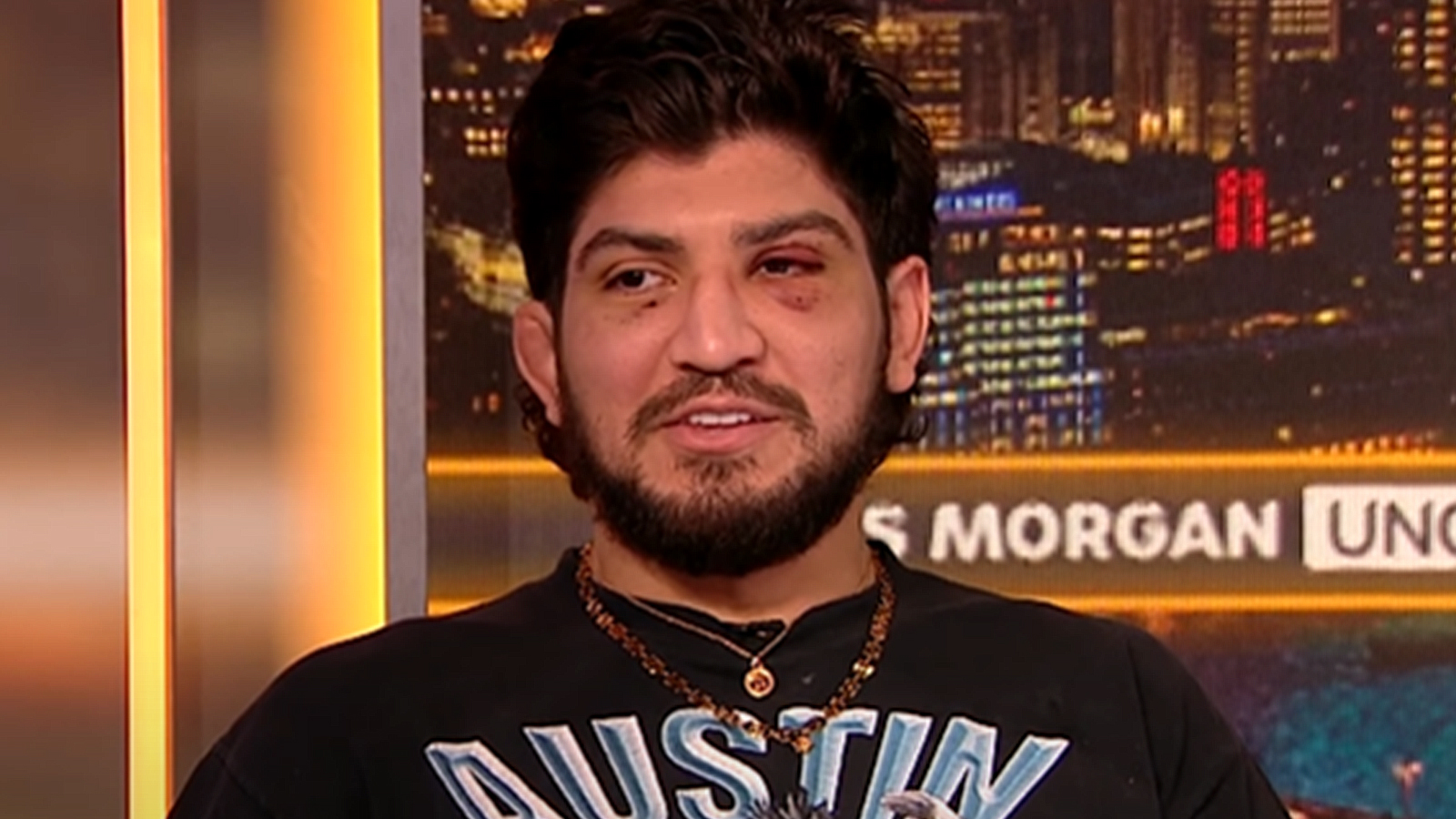 Dillon Danis Sends Message To Drake After Logan Paul Bet “i Thought We